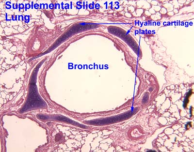 Bronchus Slide Labelled